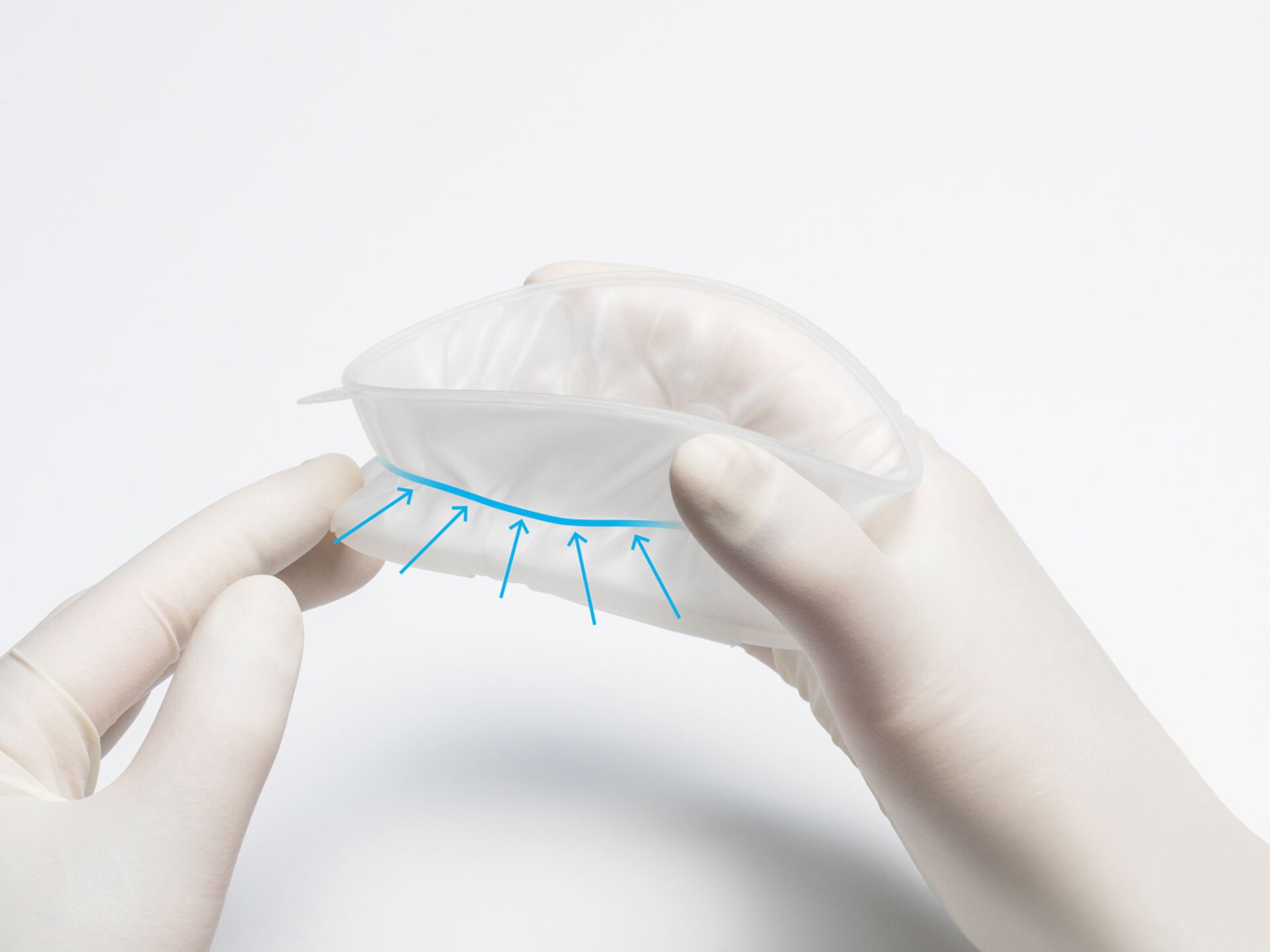 OptraGate 2 | Retractor dental | Ivoclar